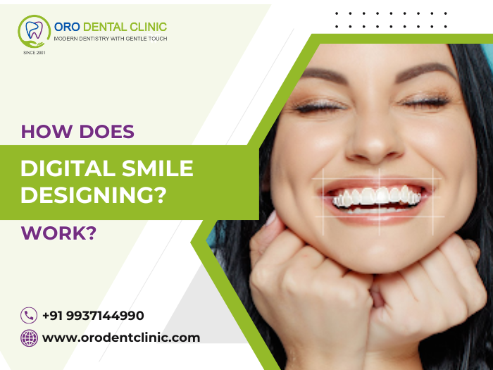 How Does Digital Smile Design Work?